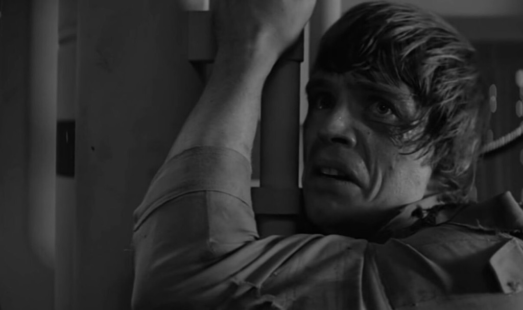 25 Real Injuries That Made It to the Screen, From Ouch To Action