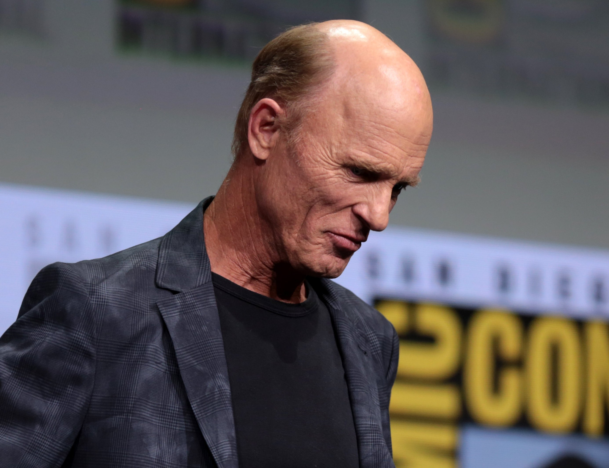 Photos Of Bald Actors—When They Had Hair