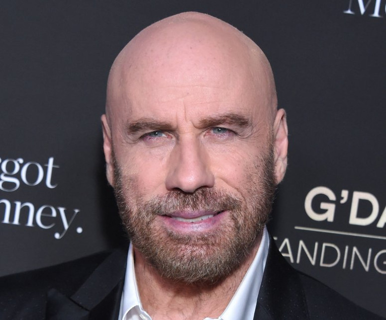 Photos Of Bald Actors—When They Had Hair