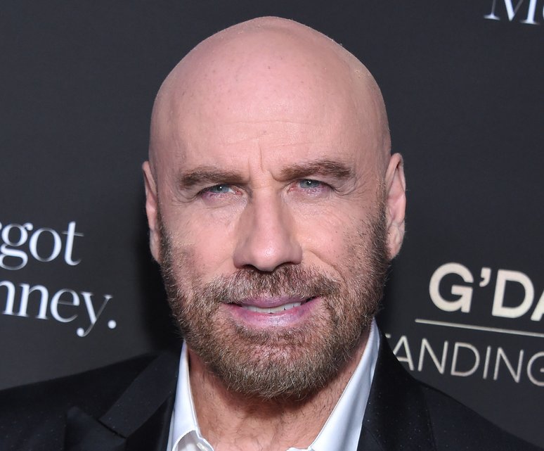 Photos Of Bald Actors—When They Had Hair