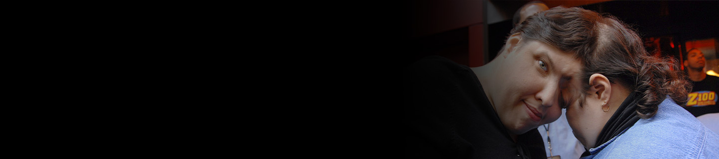 Conjoined Twins: Lori and George Schappell - TheShot