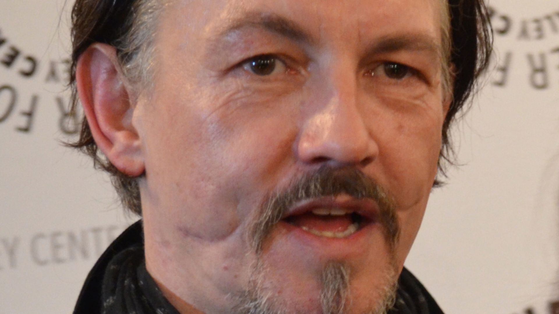 Famous Actors With Scars, And How They Got Them